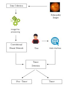 Efficient Classification Of Diabetic Retinopathy Using Binary Cnn ...